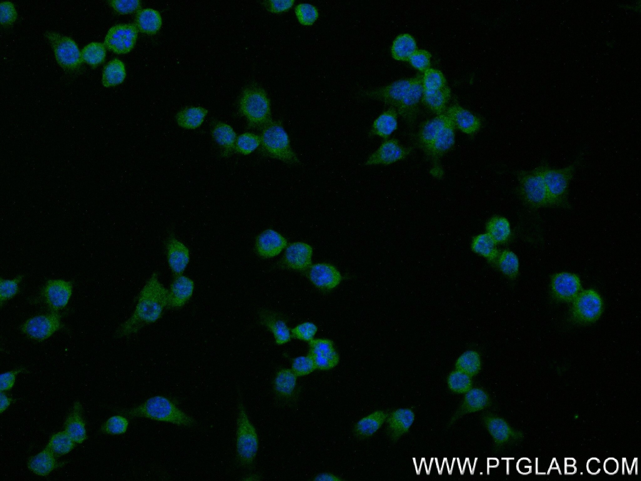 SAT1 antibody (83319-1-RR) | Proteintech