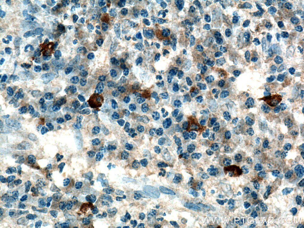 SDC2 Antibody 67088-1-Ig | Proteintech