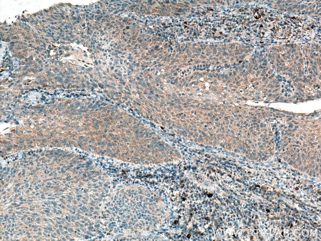 SDC2 antibody (67088-1-Ig) | Proteintech