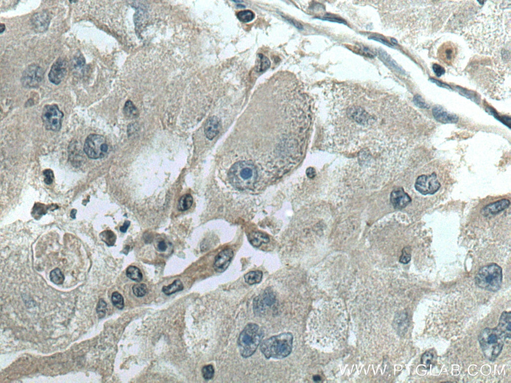 SDC4 antibody (11820-1-AP) | Proteintech