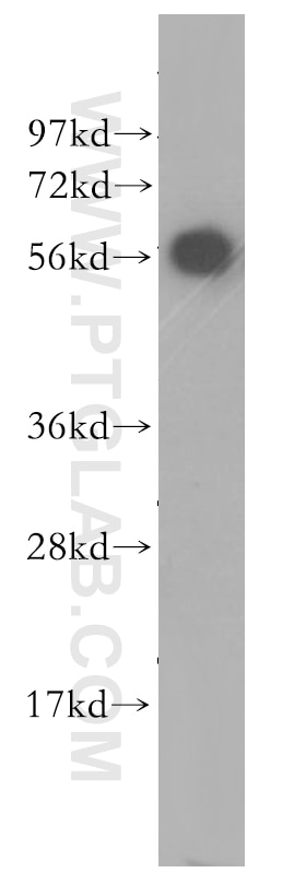 Sep (O-Phosphoserine) TRNA:Sec (Selenocysteine) TRNA Synthase ...