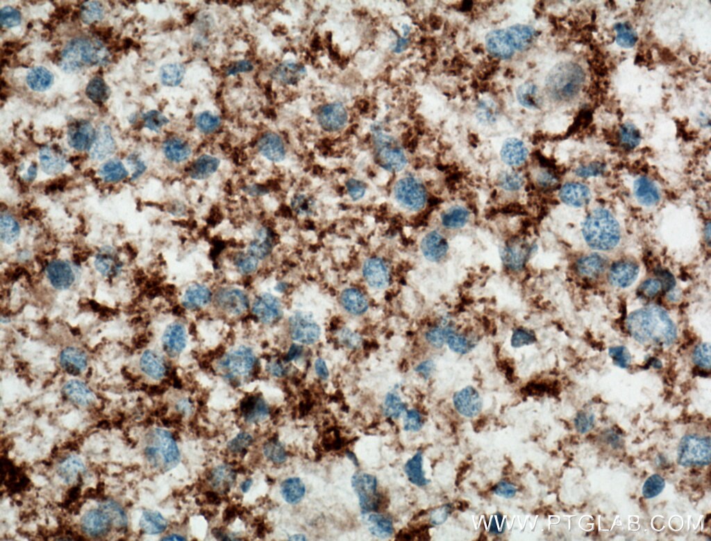 Septin 5 antibody (11631-1-AP) | Proteintech