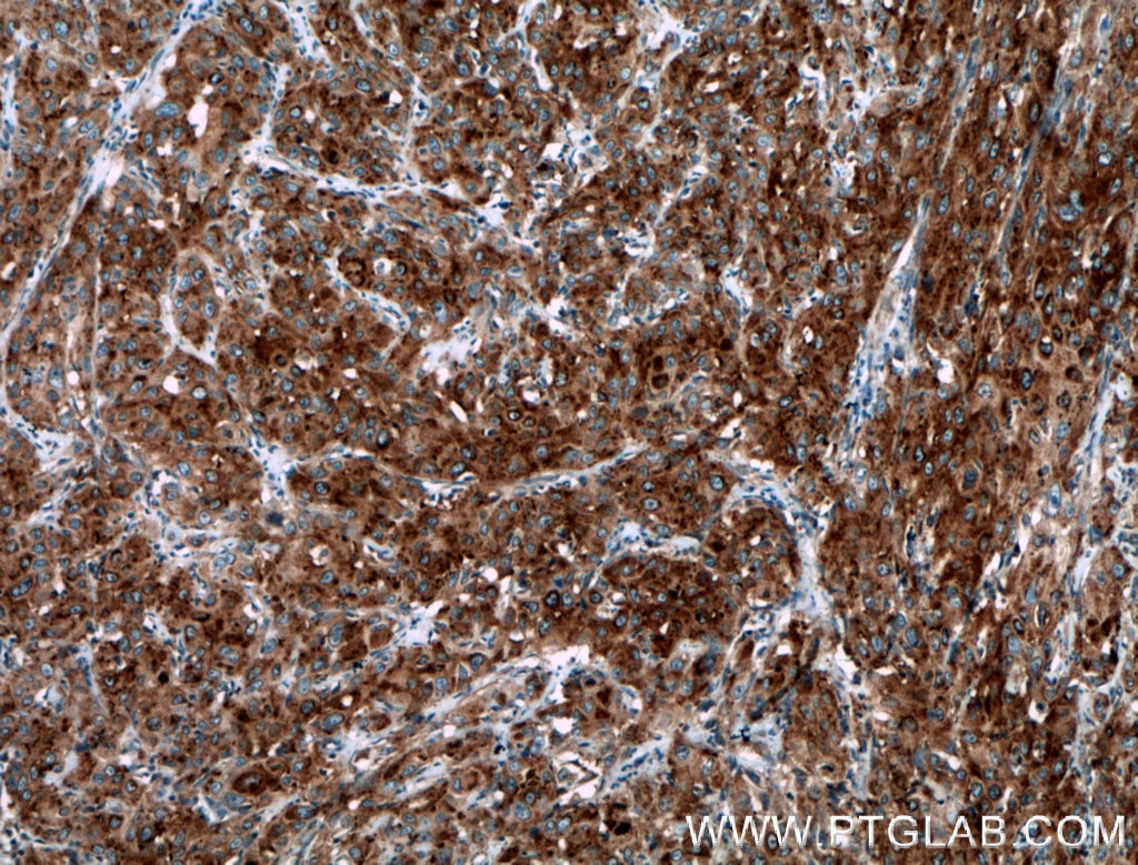 Septin 6 antibody (12805-1-AP) | Proteintech