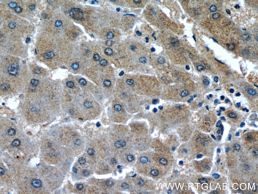 HSP47 antibody (10875-1-AP) | Proteintech