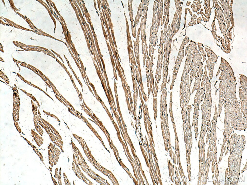 SERTAD1 antibody (10167-1-AP) | Proteintech