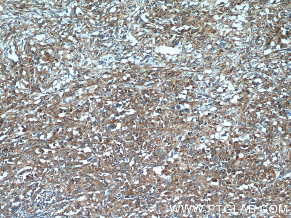 SGK3 antibody (12699-1-AP) | Proteintech