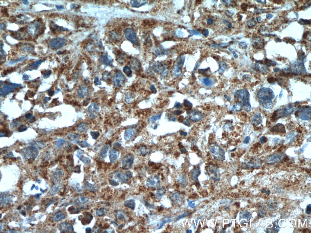 SGK3 antibody (12699-1-AP) | Proteintech