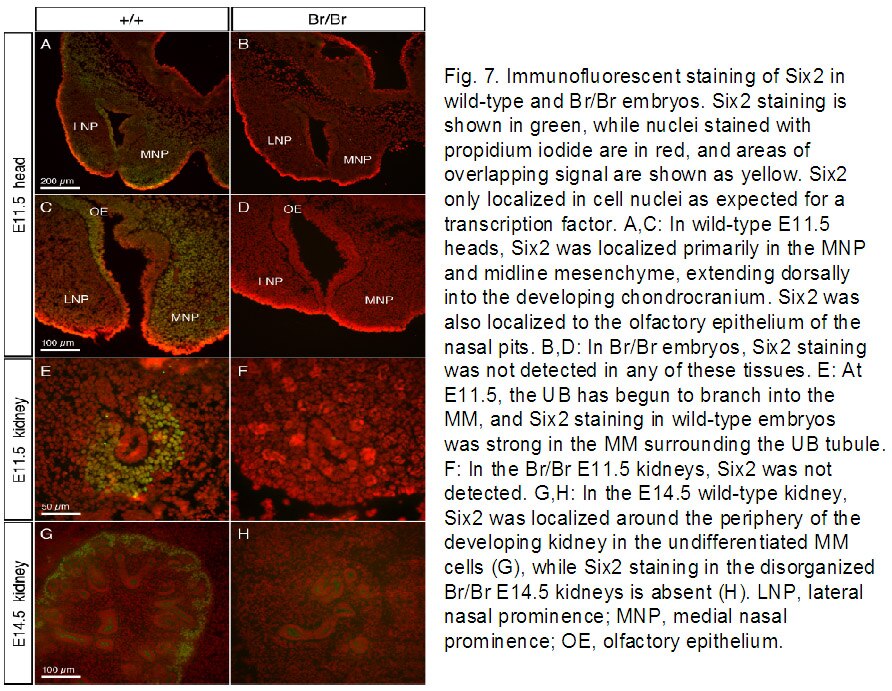 SIX2 antibody (11562-1-AP) | Proteintech
