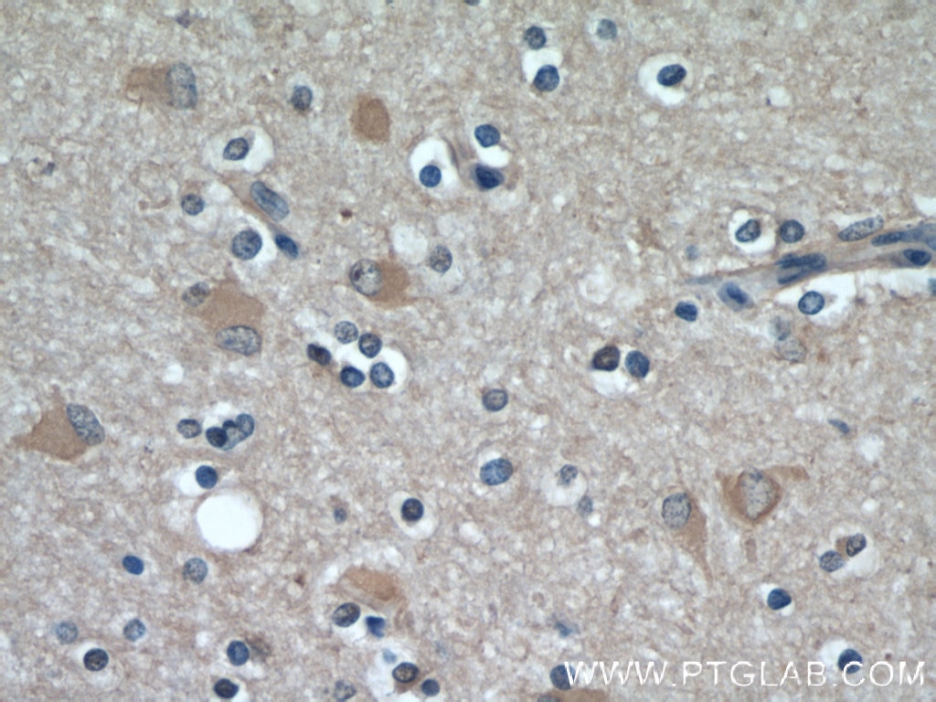 VGLUT1 antibody (55491-1-AP) | Proteintech