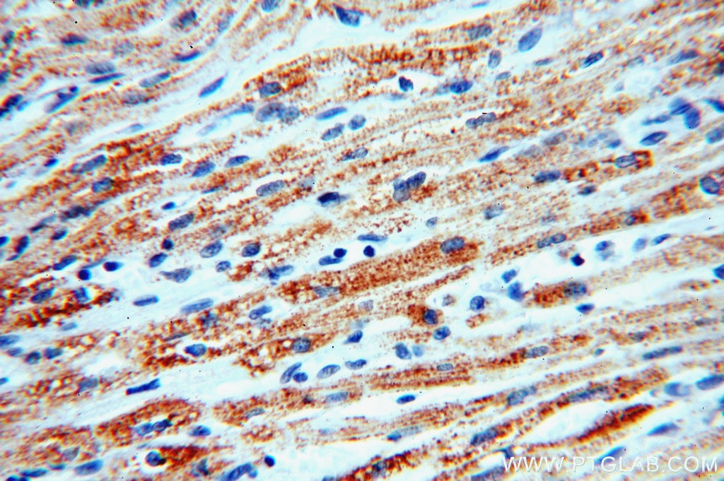 SLC25A20 antibody (19363-1-AP) | Proteintech