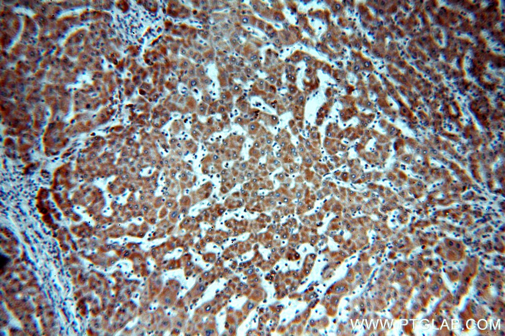 SLC25A20 antibody (19363-1-AP) | Proteintech