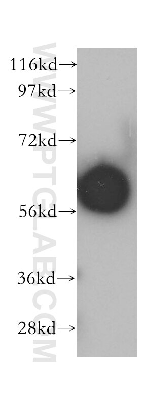 SLC38A3 antibody (14315-1-AP) | Proteintech