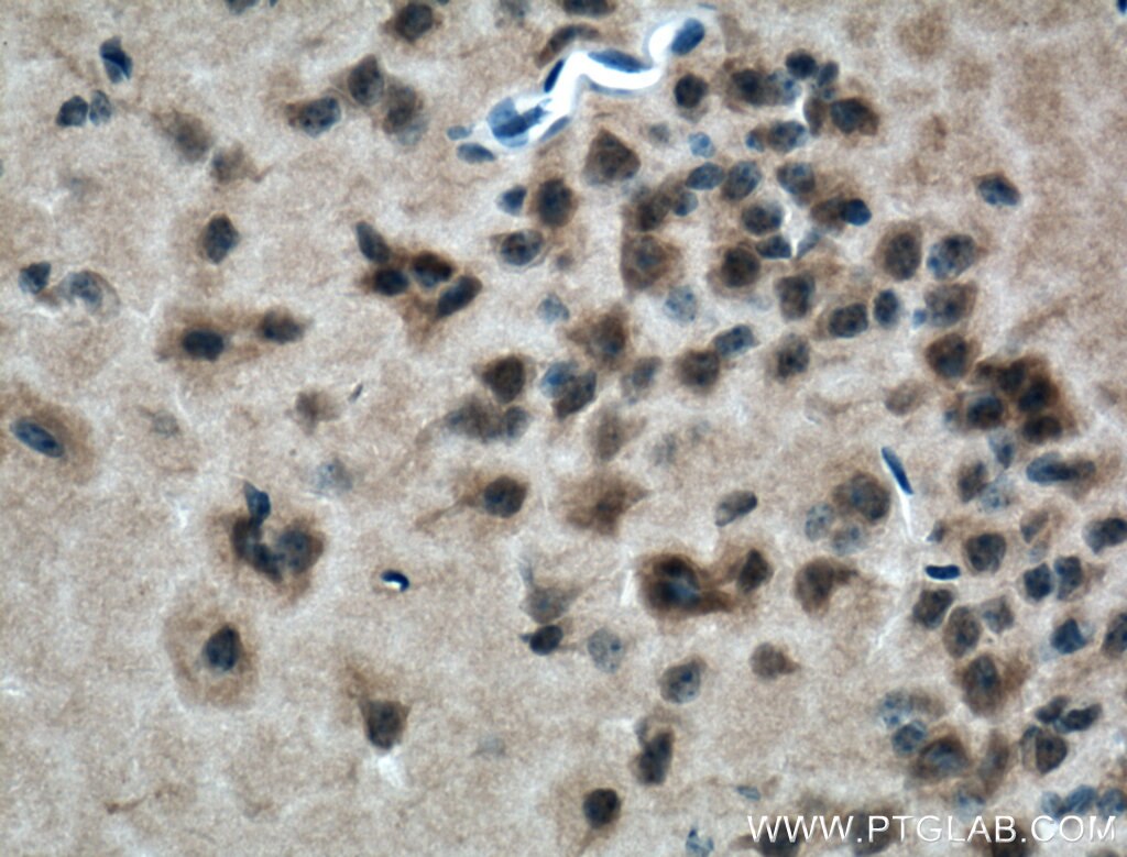 SLC44A1 antibody (14687-1-AP) | Proteintech