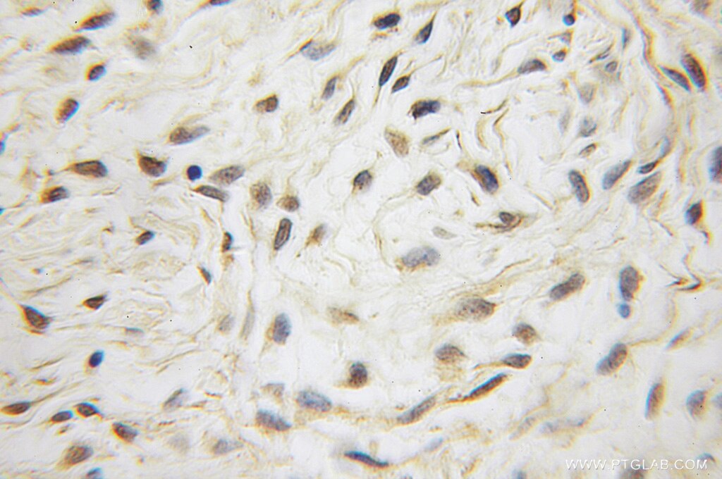 SMAD2 Antibody 12570-1-AP | Proteintech