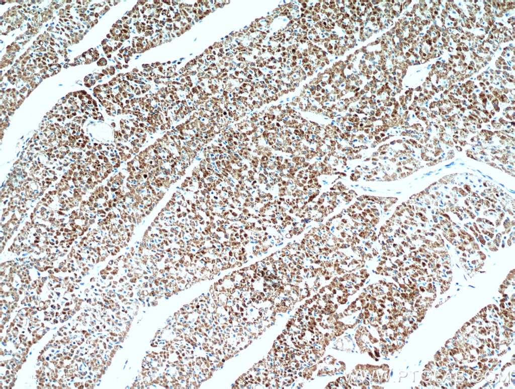 SMAD4 antibody (51144-1-AP) | Proteintech