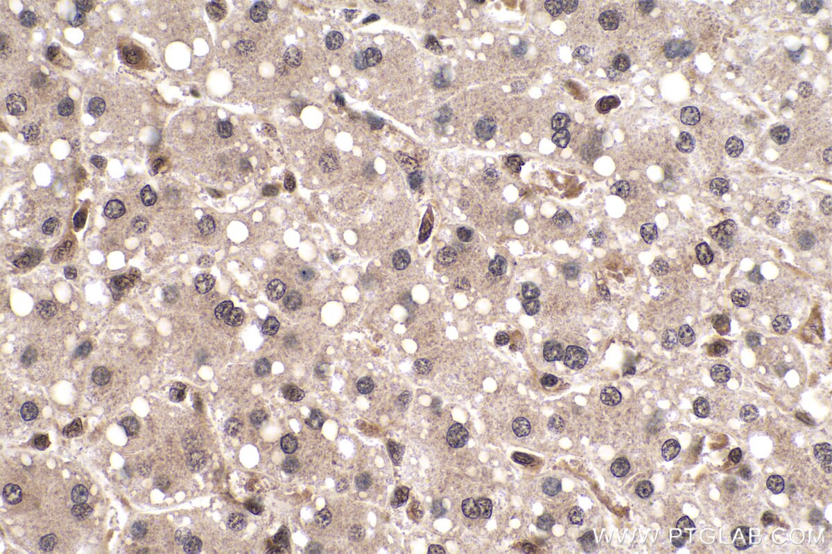 SMAD2 antibody (67343-1-Ig) | Proteintech