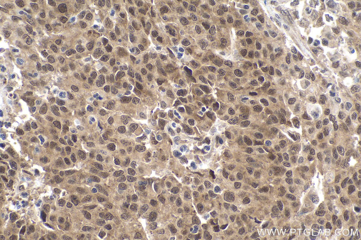 SMAD2 antibody (67343-1-Ig) | Proteintech