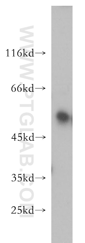 SNX17 antibody (10275-1-AP) | Proteintech