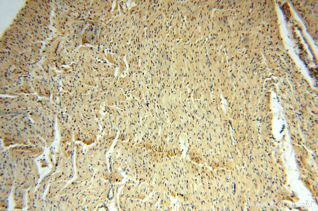 SOD1 Antibody 10269-1-AP | Proteintech