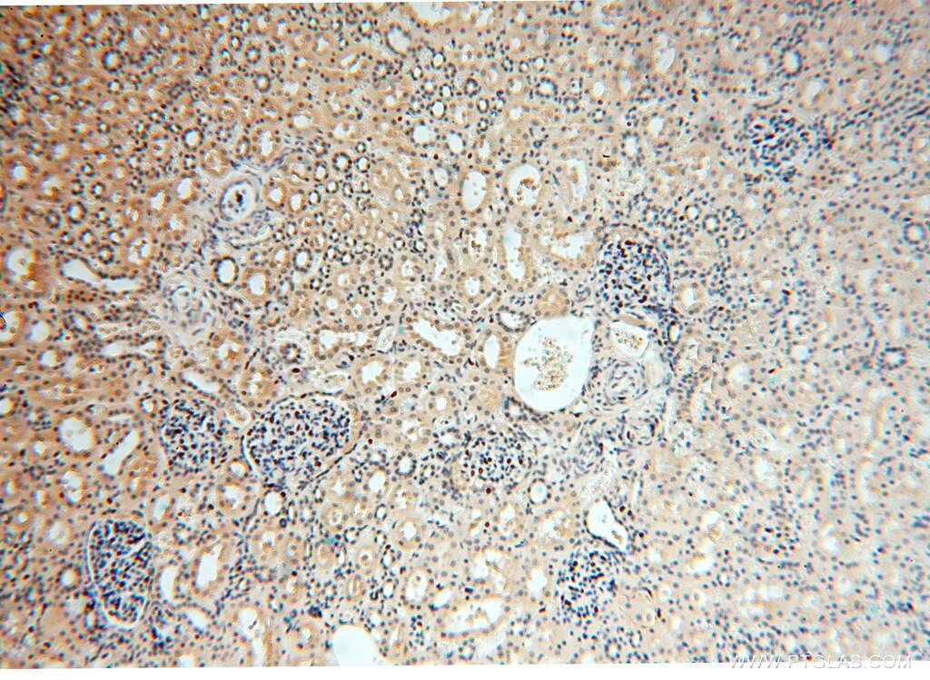 SOD1 Antibody 10269-1-AP | Proteintech