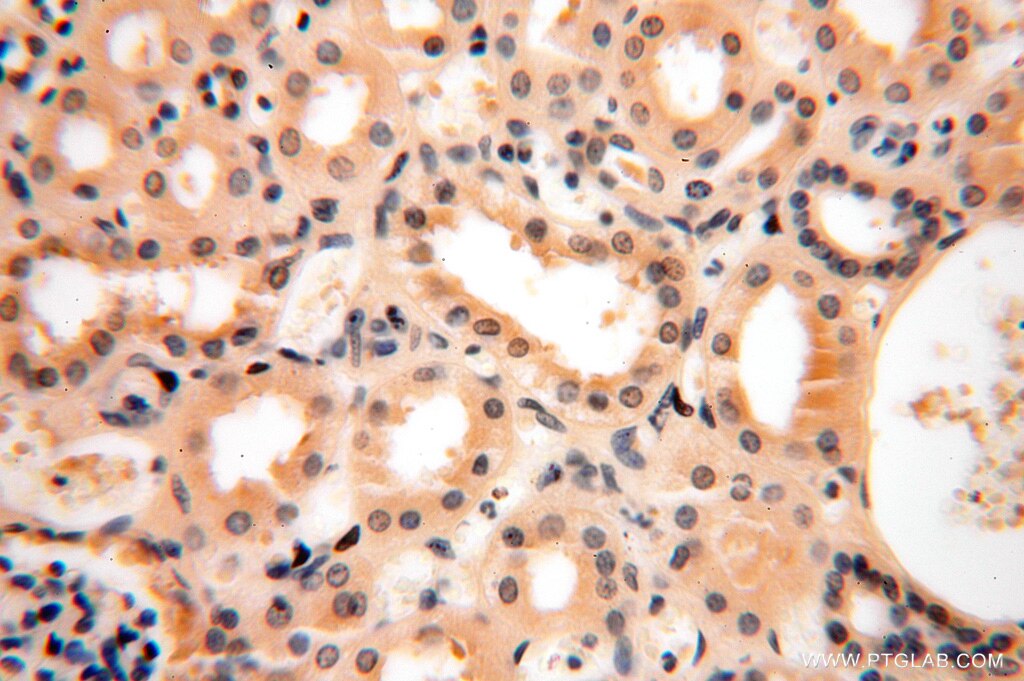 SOD1 Antibody 10269-1-AP | Proteintech