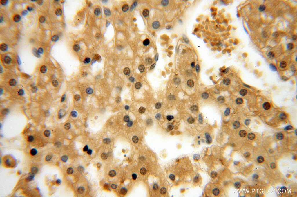 SOD1 Antibody 10269-1-AP | Proteintech