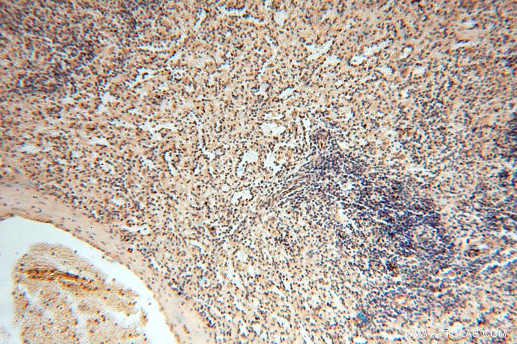 SOD1 Antibody 10269-1-AP | Proteintech