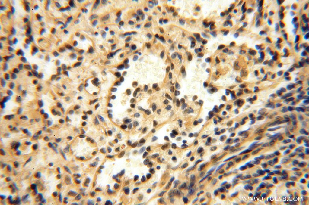 SOD1 Antibody 10269-1-AP | Proteintech