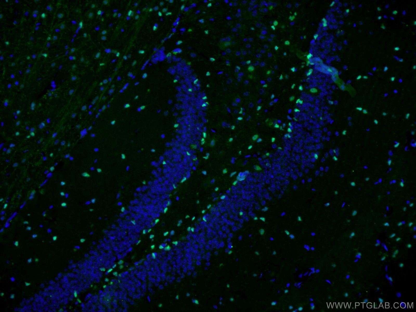 SOX2 antibody (66411-1-Ig) | Proteintech