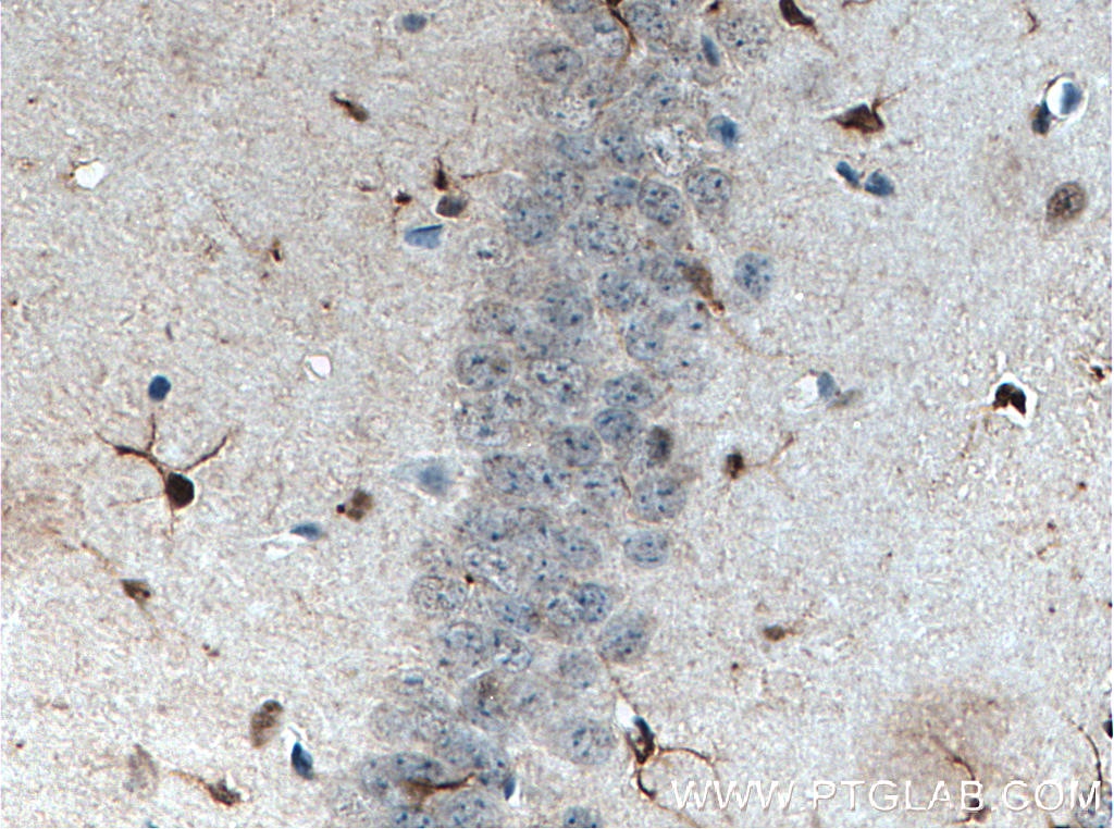 SOX2 antibody (66411-1-Ig) | Proteintech