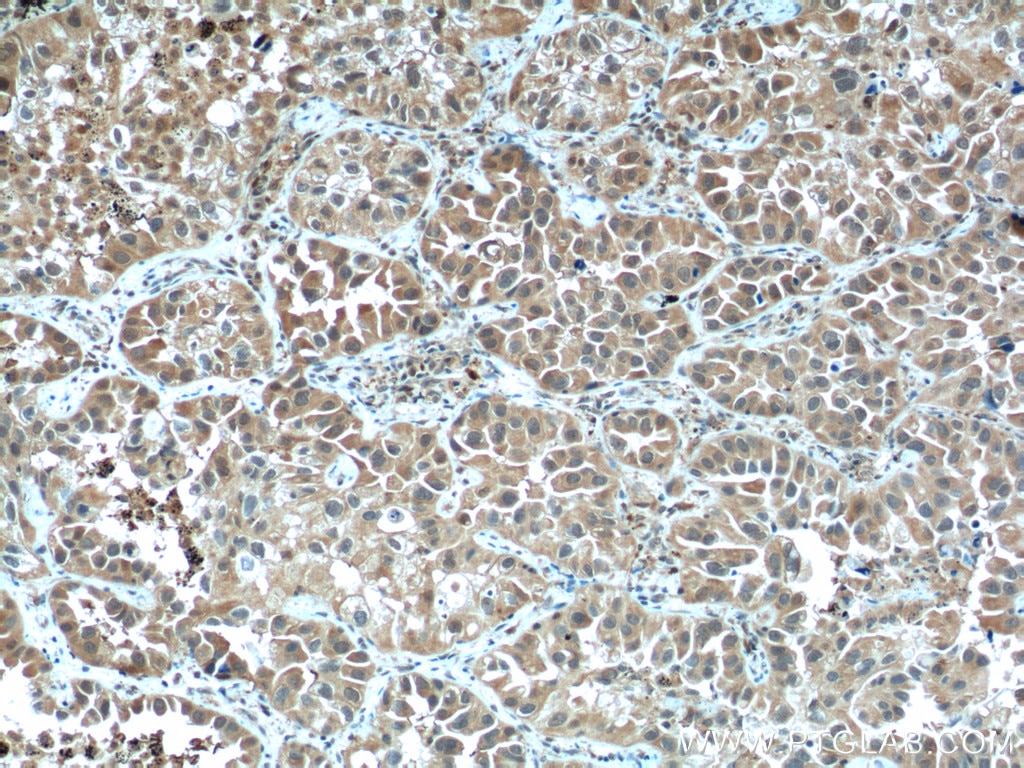 STAT3 antibody (51076-2-AP) | Proteintech