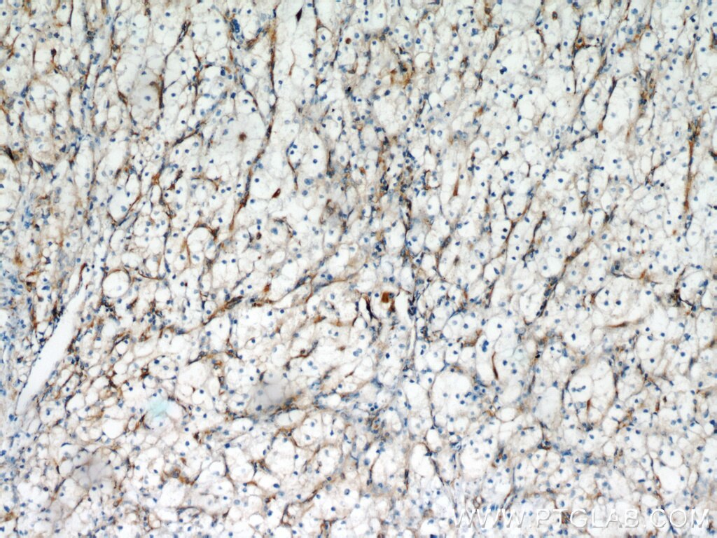 Stanniocalcin 2 Antibody 10314-1-AP | Proteintech