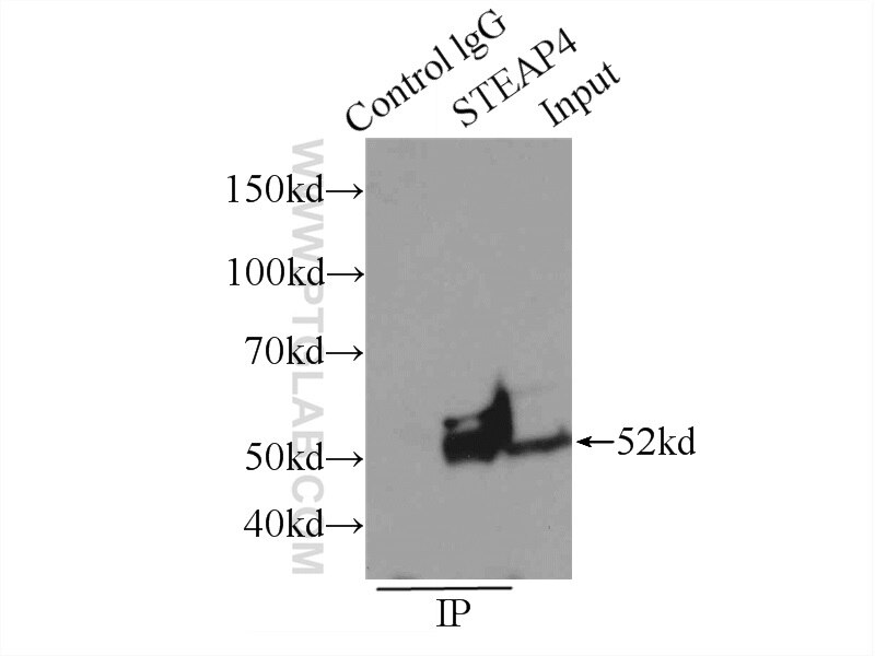 STEAP4 Antibody 11944-1-AP | Proteintech