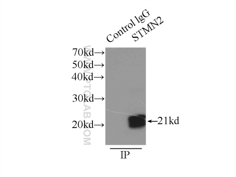 STMN2 Antibody 10586-1-AP | Proteintech