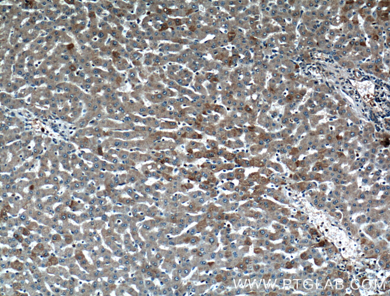STT3B antibody (15323-1-AP) | Proteintech
