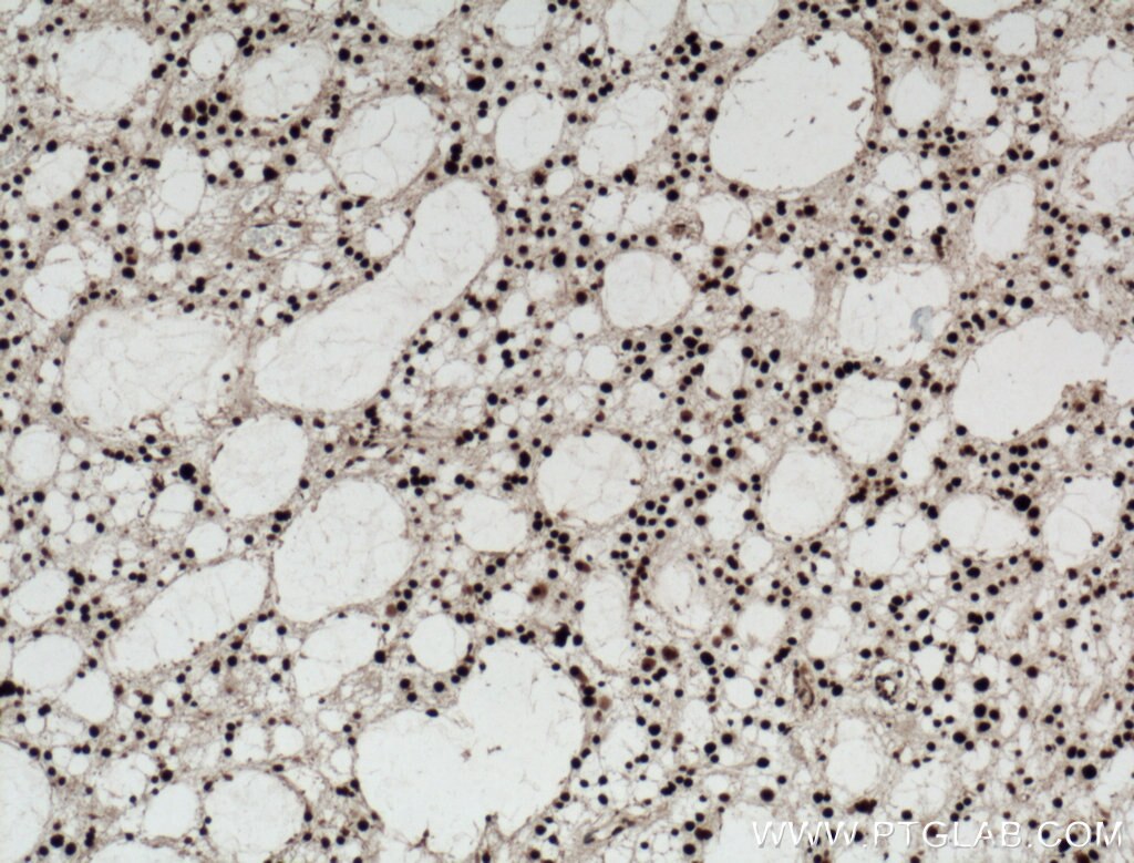 SUB1 antibody (11956-1-AP) | Proteintech