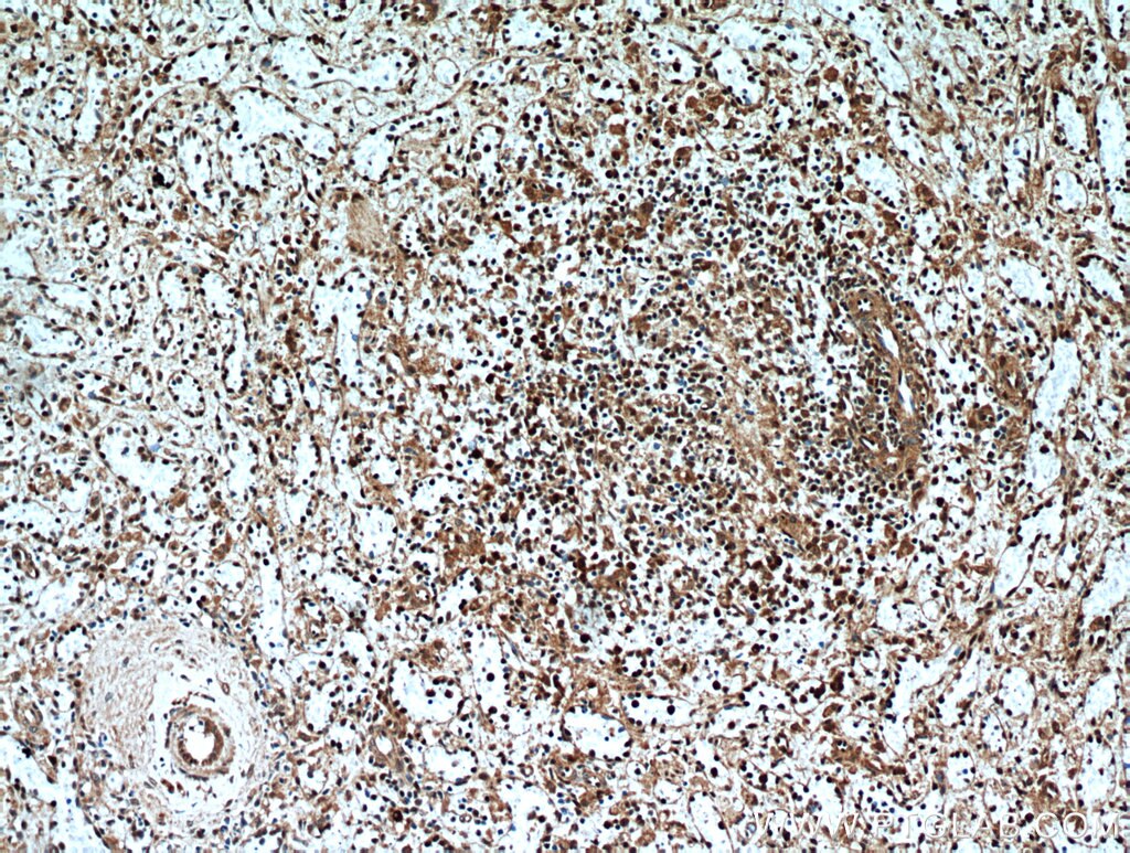 SUPT16H antibody (20551-1-AP) | Proteintech