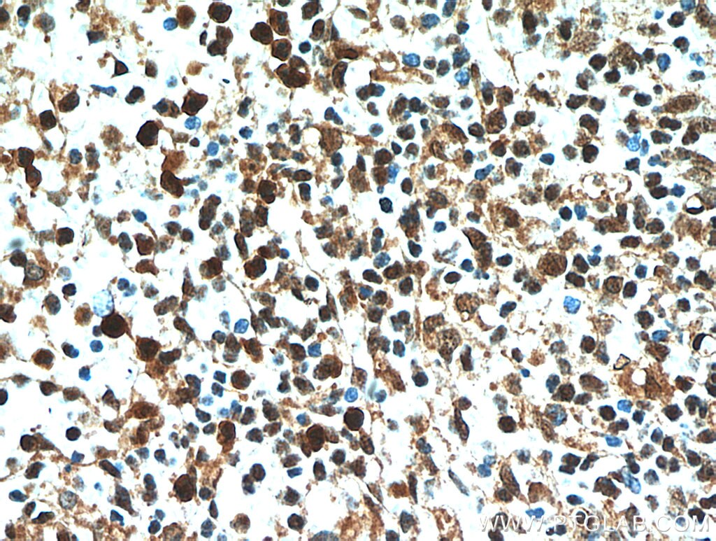 SUPT16H antibody (20551-1-AP) | Proteintech