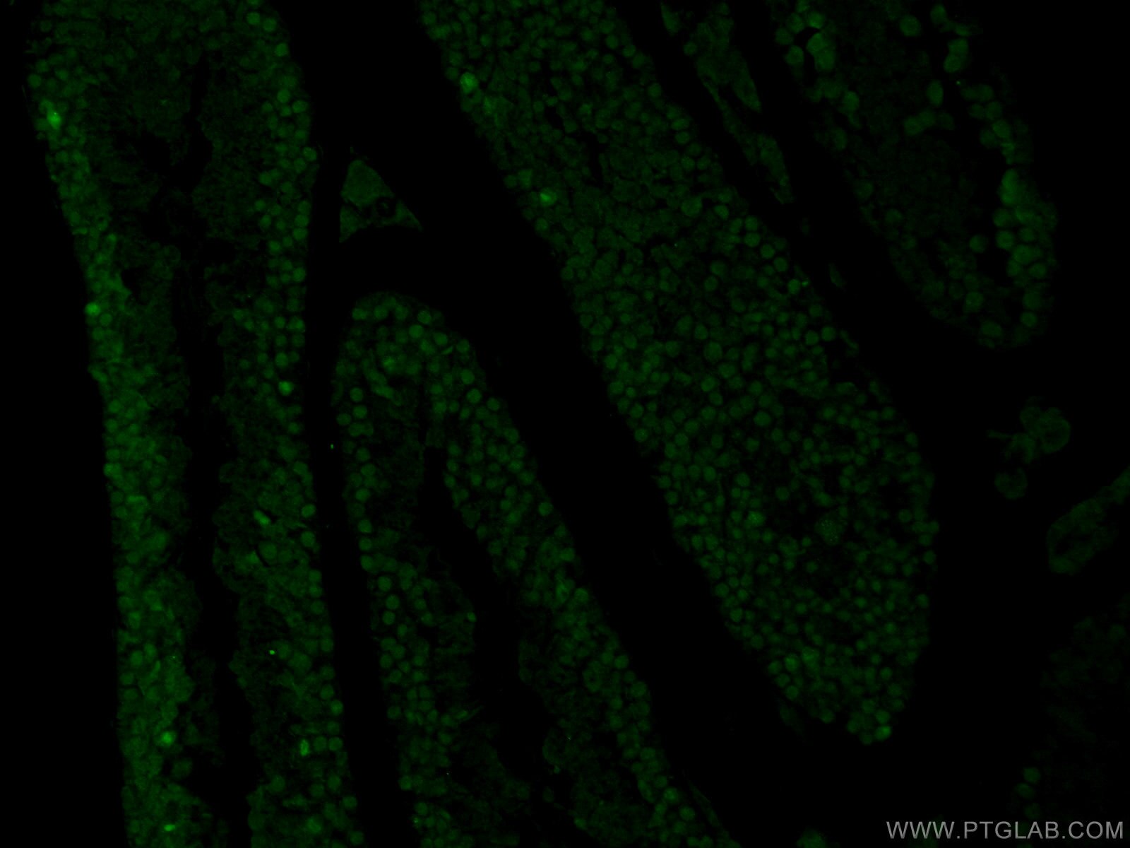 SCP3 Antibody 23024-1-AP | Proteintech