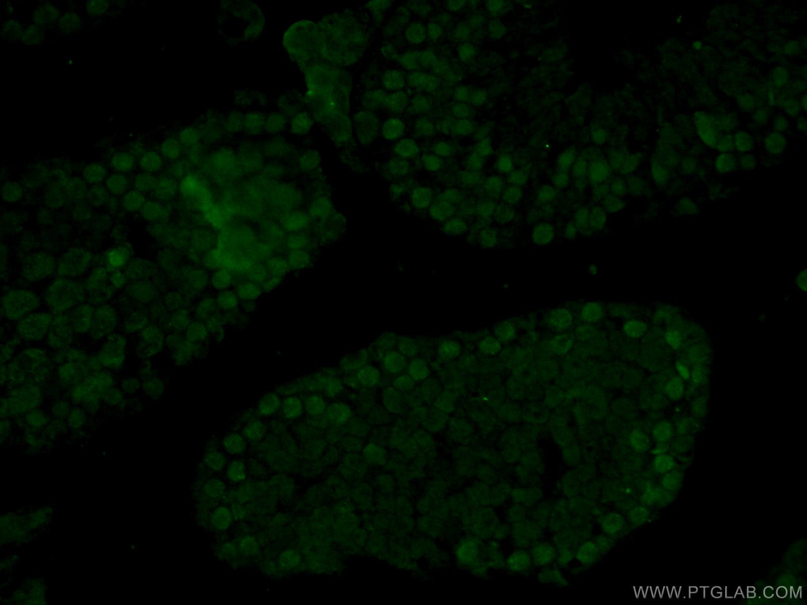 SCP3 Antibody 23024-1-AP | Proteintech