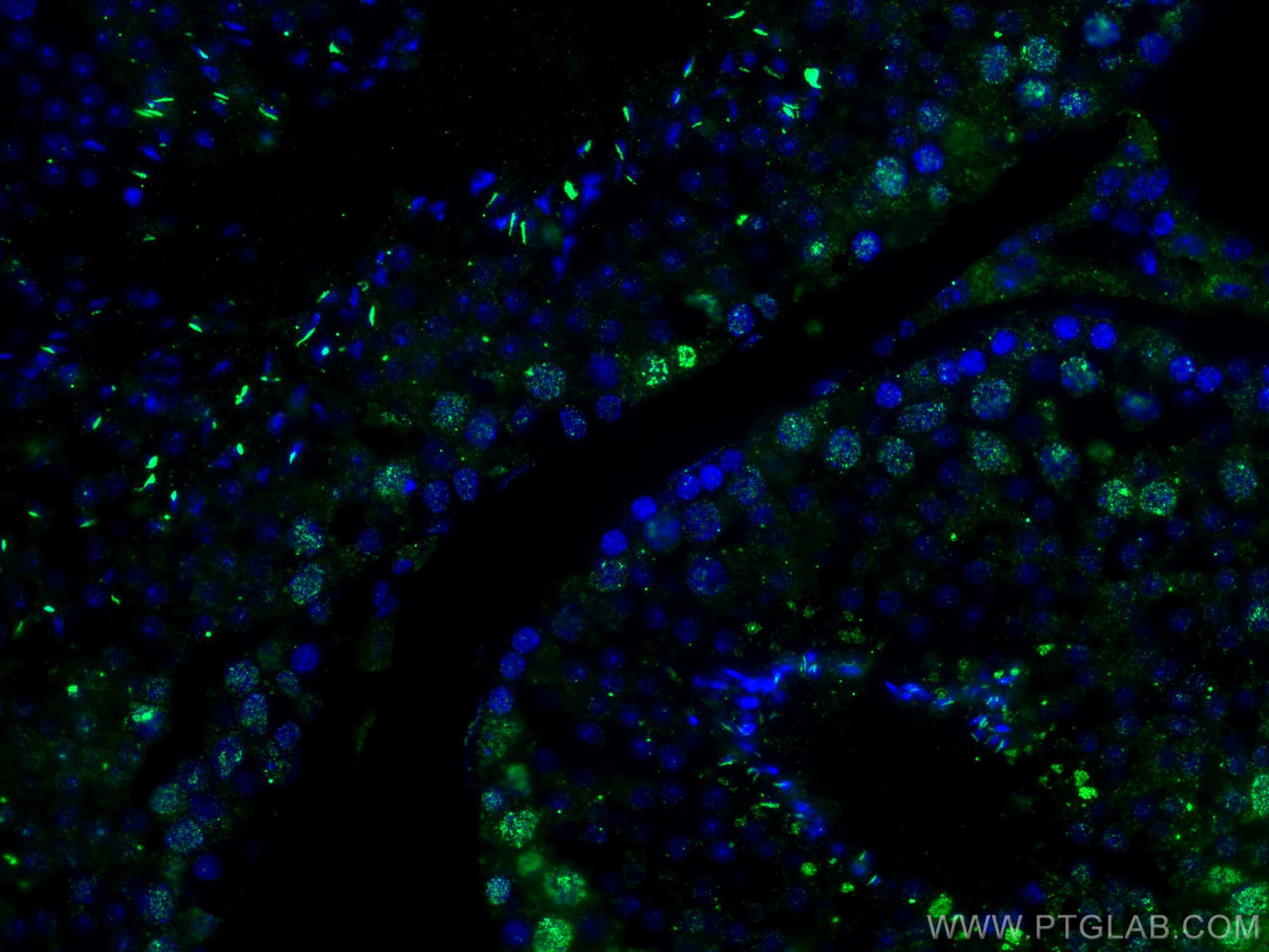 SCP3 Antibody 23024-1-AP | Proteintech