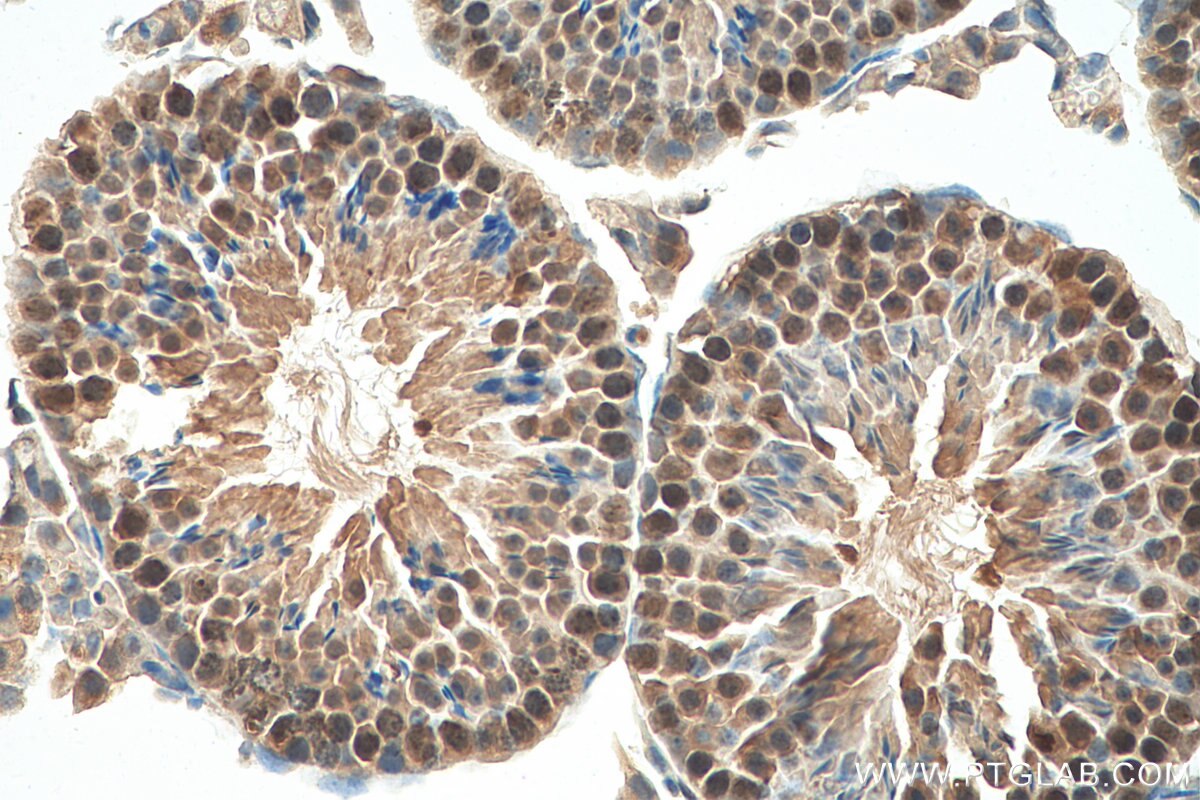 SCP3 Antibody 23024-1-AP | Proteintech