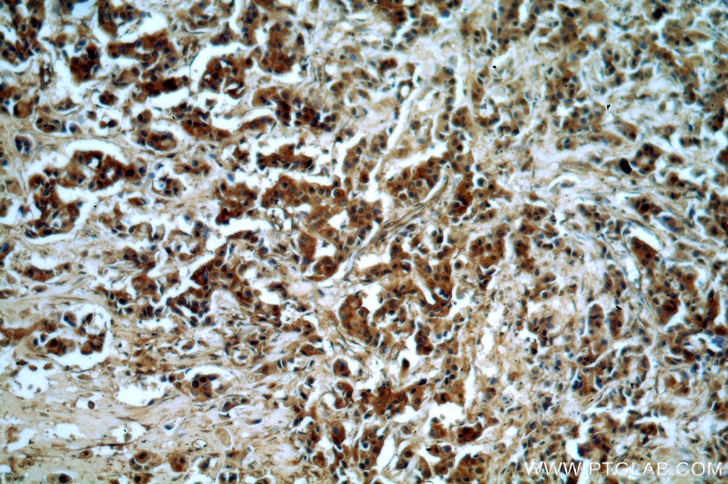 Sestrin 2 antibody (10795-1-AP) | Proteintech