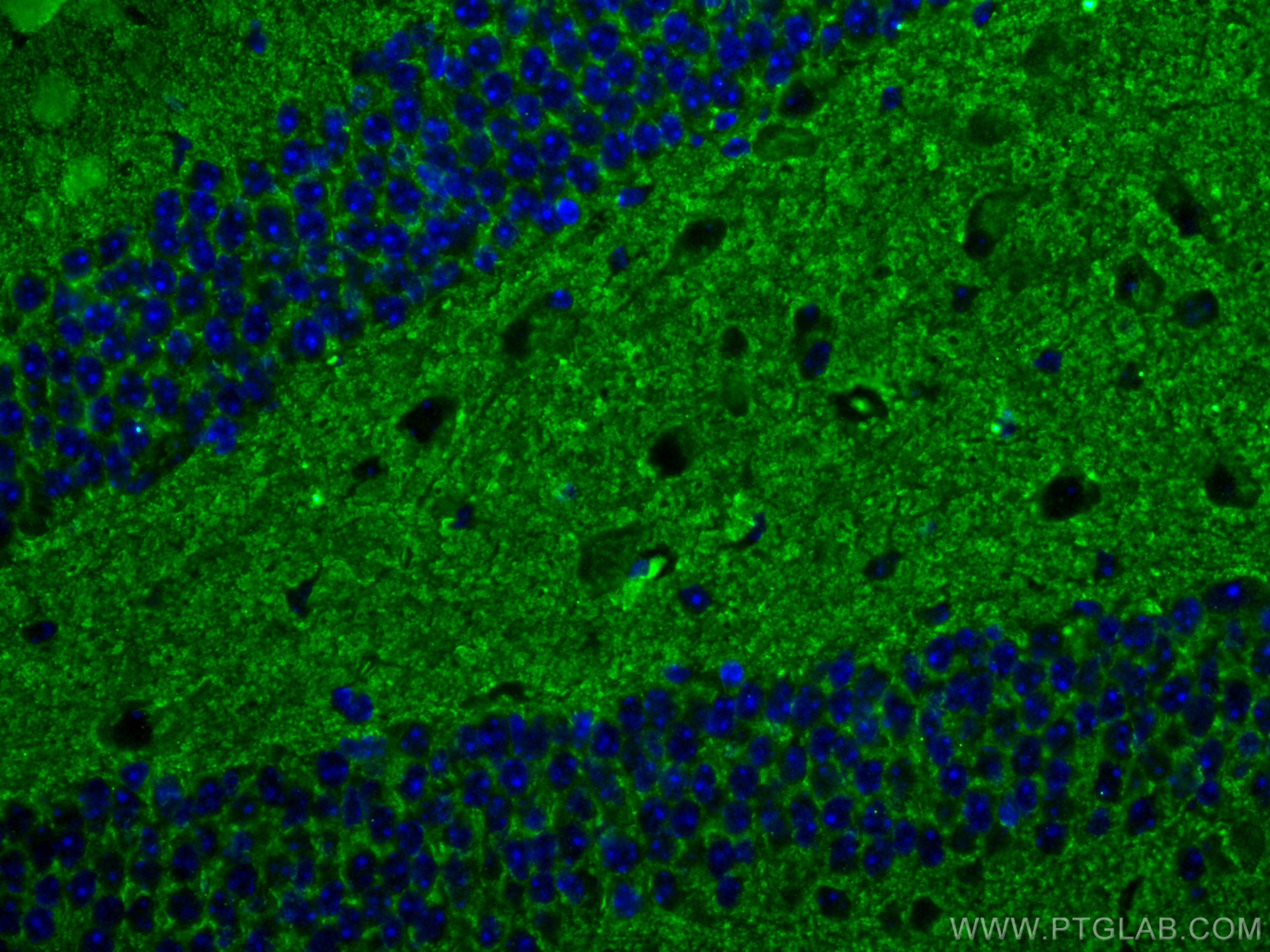 Synaptophysin antibody (67864-1-Ig) | Proteintech