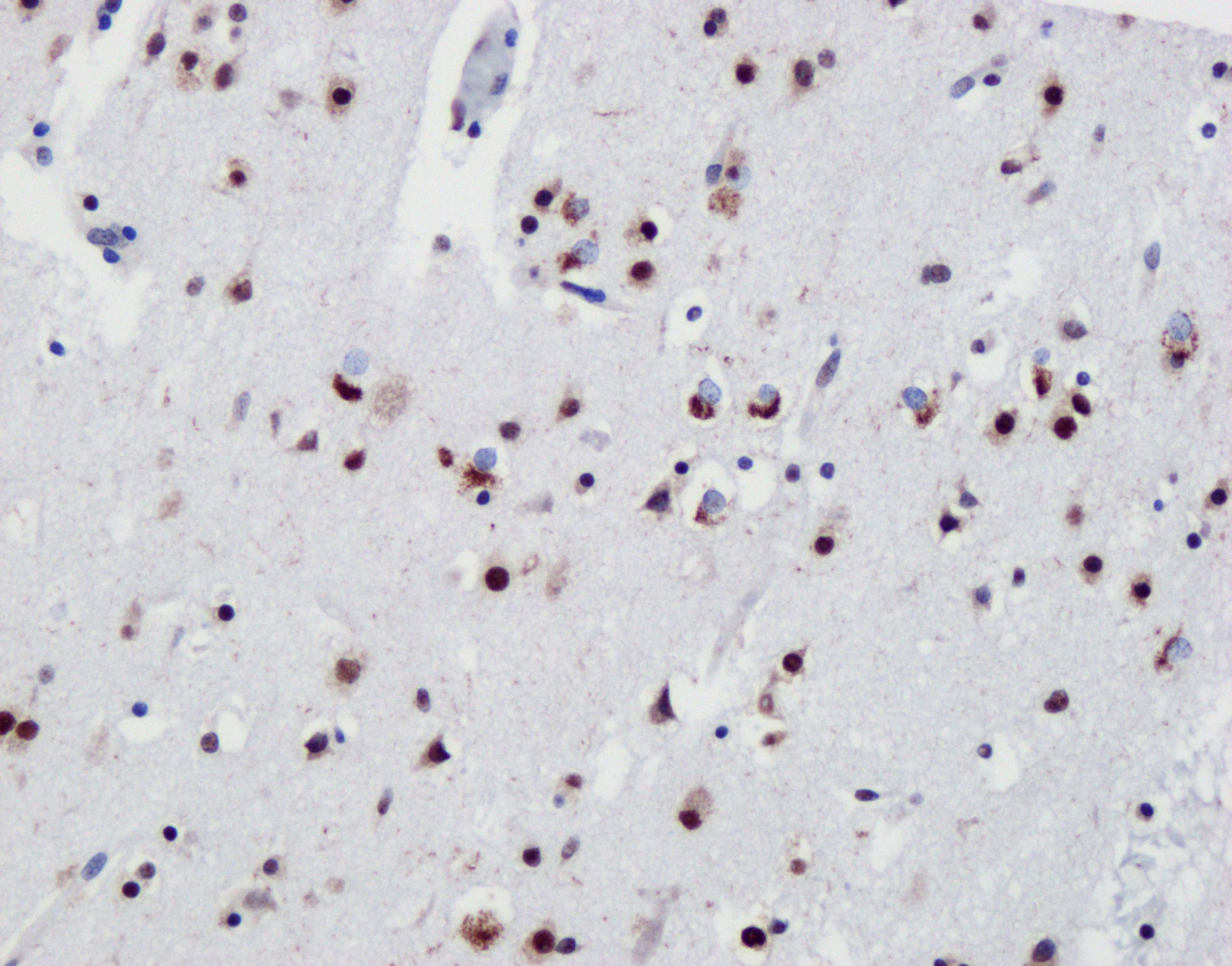 TDP-43 (N-terminal) antibody (80001-1-RR) | Proteintech