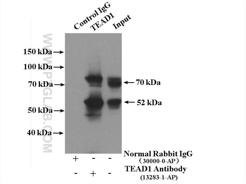 TEAD1 Antibody 13283-1-AP | Proteintech
