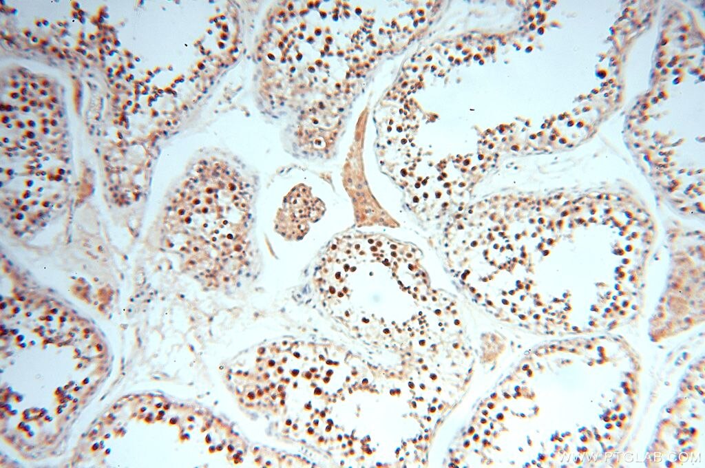 TEX11 antibody (17266-1-AP) | Proteintech