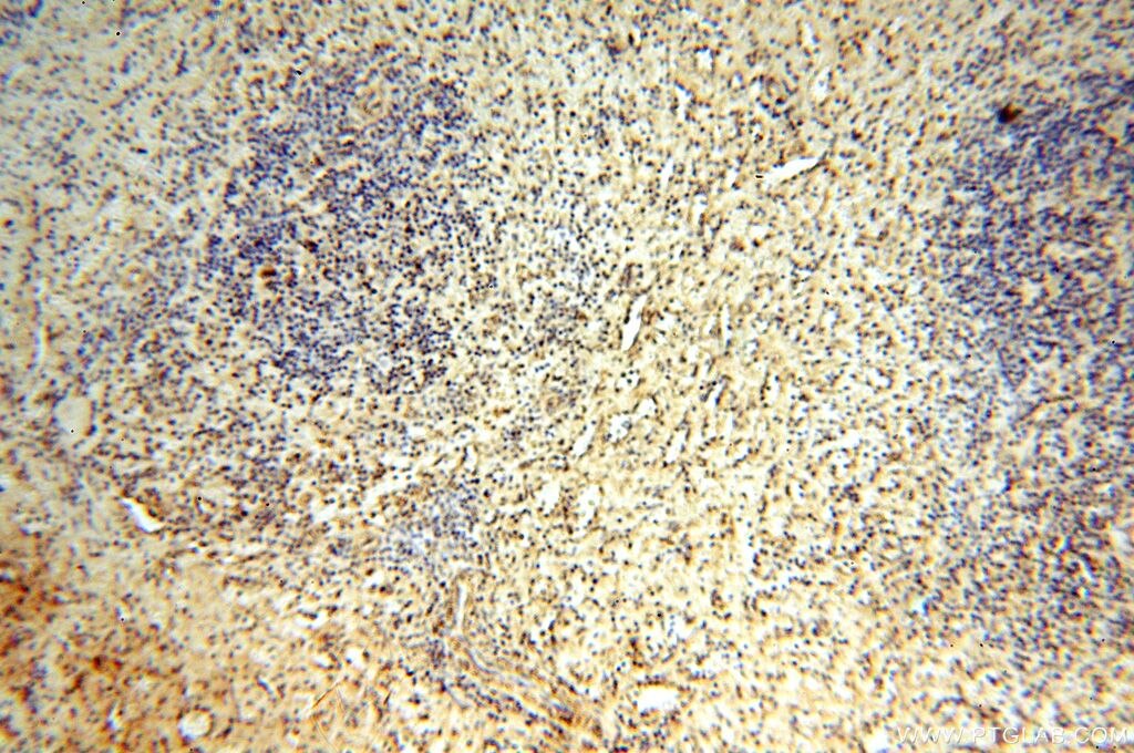 TEX11 Antibody 17266-1-AP | Proteintech