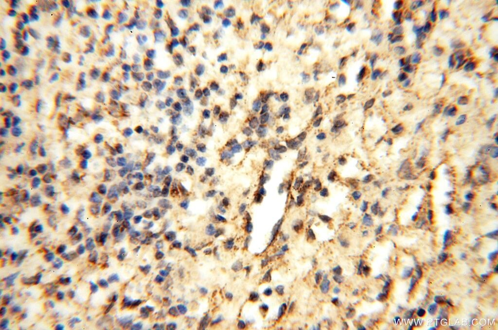 TEX11 Antibody 17266-1-AP | Proteintech