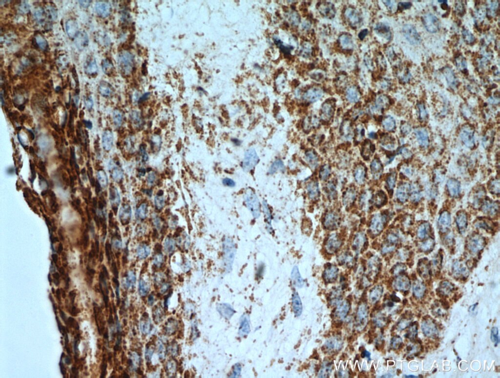 TEX11 Antibody 17266-1-AP | Proteintech